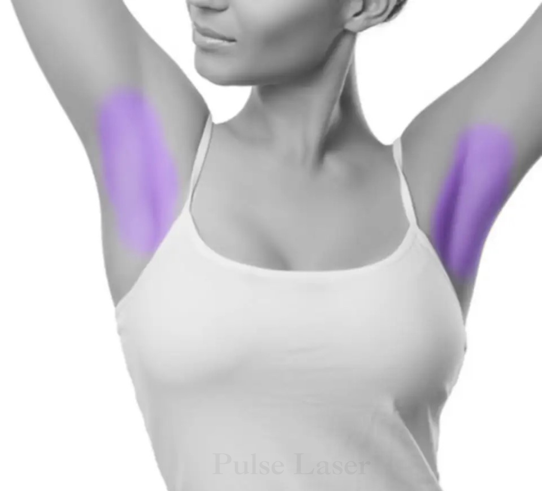 Underarms Laser – Pulse Laser at The Chookpen Spa